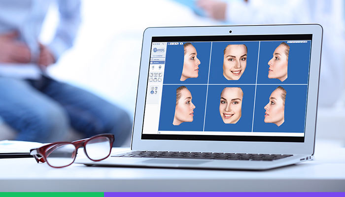 Nose Job in Iran - Best Surgeons, Lowest Price- Floramedtour