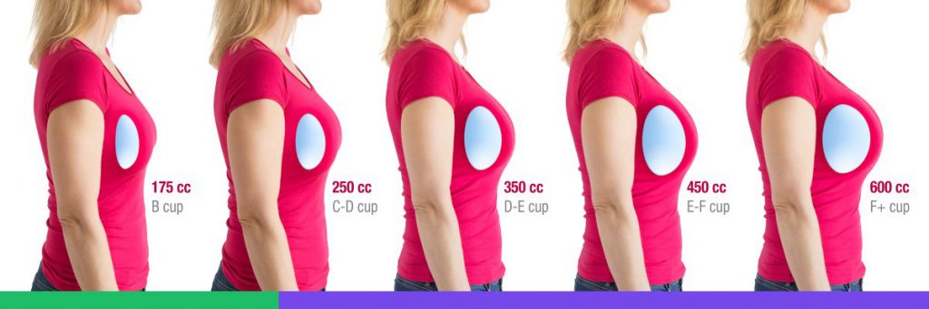 Breast Augmentation in Iran - The safest breast surgery - Floramedtour